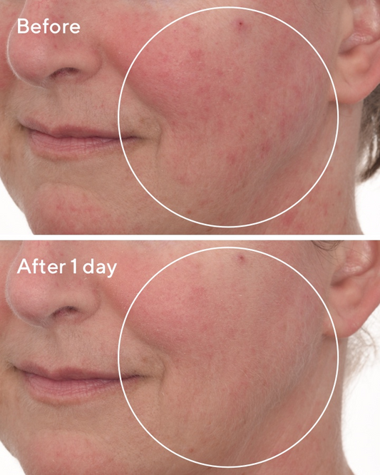 Cellular Hydration Barrier Repair Sleep Mask – Murad Canada