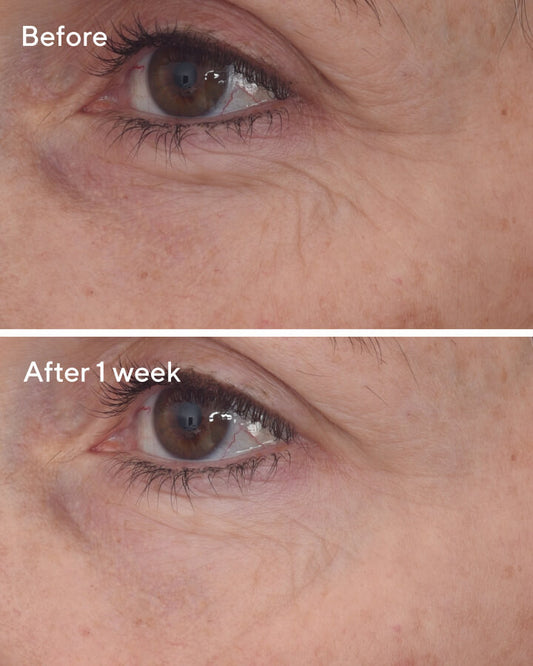 Retinal ReSculpt Eye Lift Treatment – Murad Canada